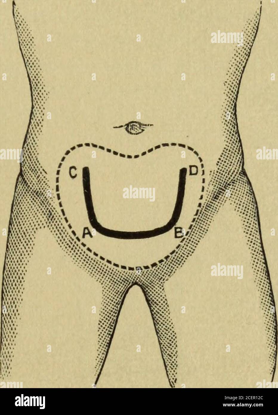 The layers of the skin and the bone hi-res stock photography and images ...