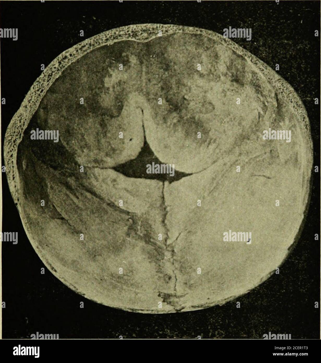 Head proportion age hi-res stock photography and images - Alamy