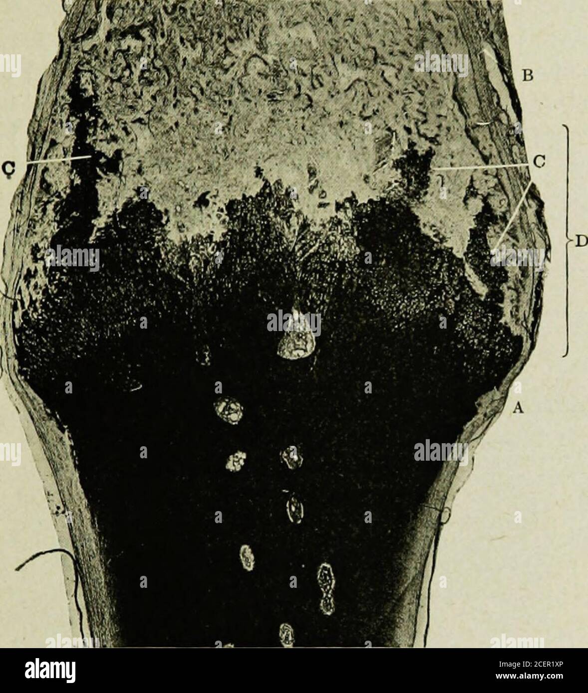 . The diseases of infancy and childhood. duringthe period of active ...