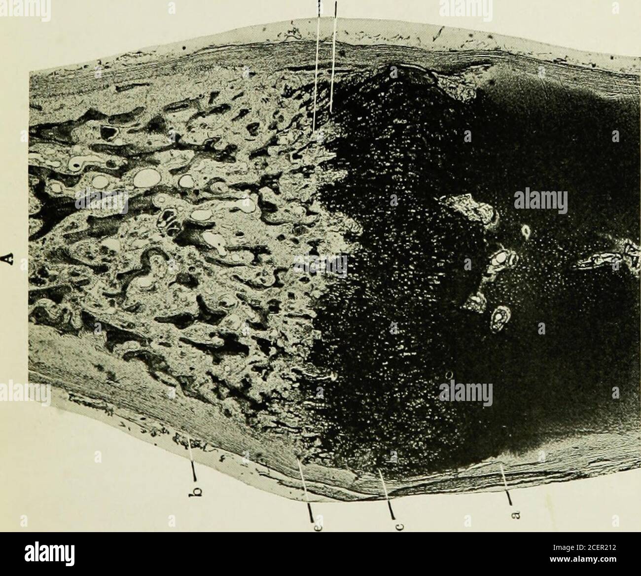 Longitudinal section long bone hi-res stock photography and images - Alamy