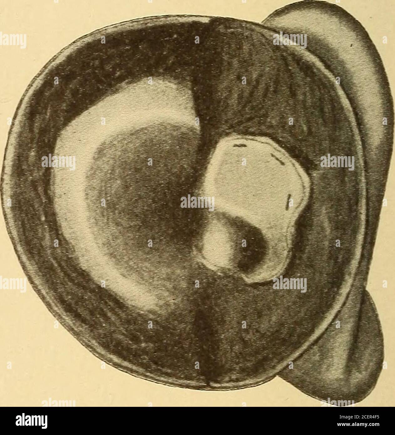 . Diseases of the ear; a text-book for practitioners and students of ...