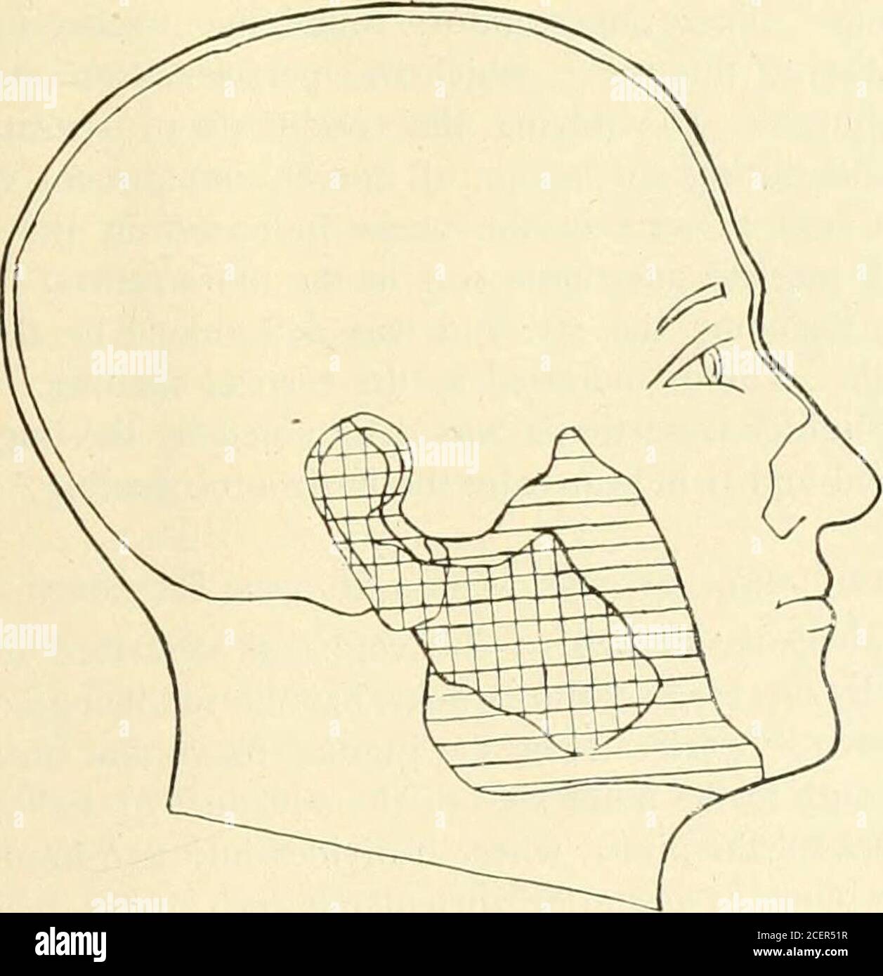 Severed ear hi-res stock photography and images - Alamy