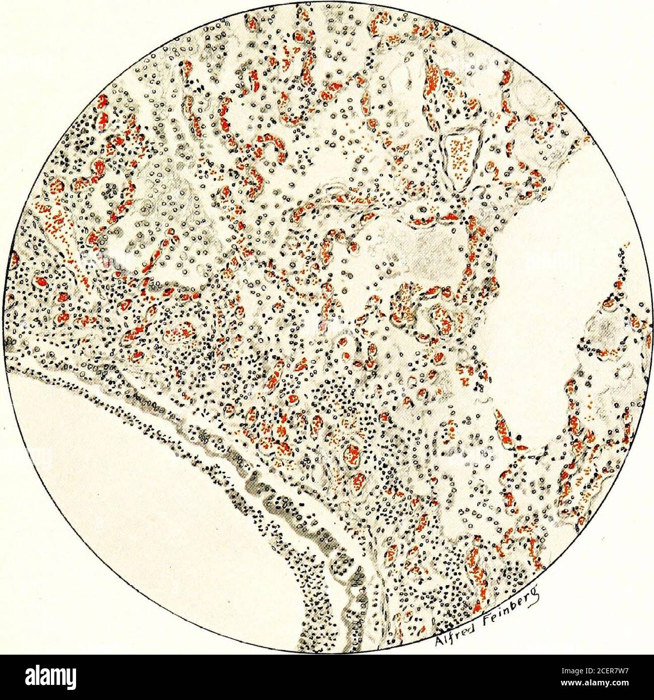 . The pathology of the pneumonia in the United States army camps during ...