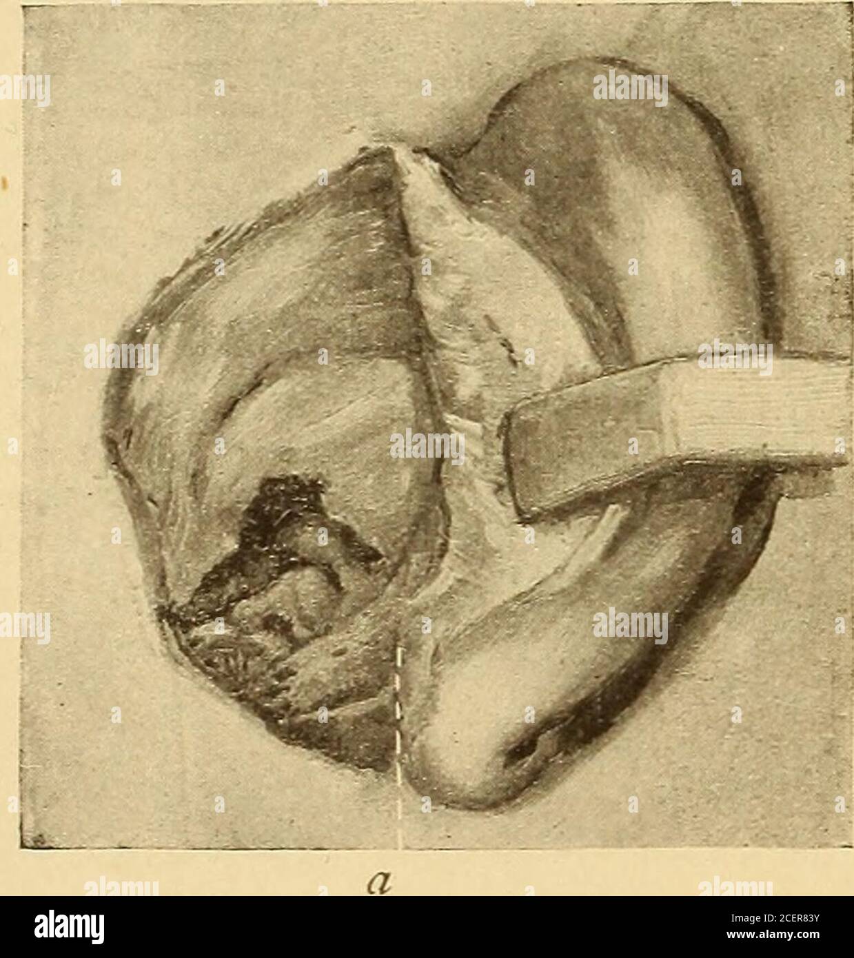 Stylomastoid foramen hi-res stock photography and images - Alamy