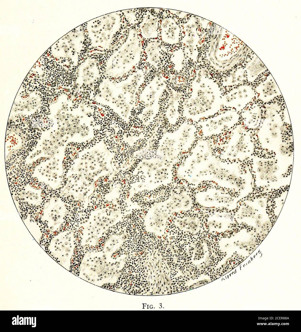 . The pathology of the pneumonia in the United States army camps during ...