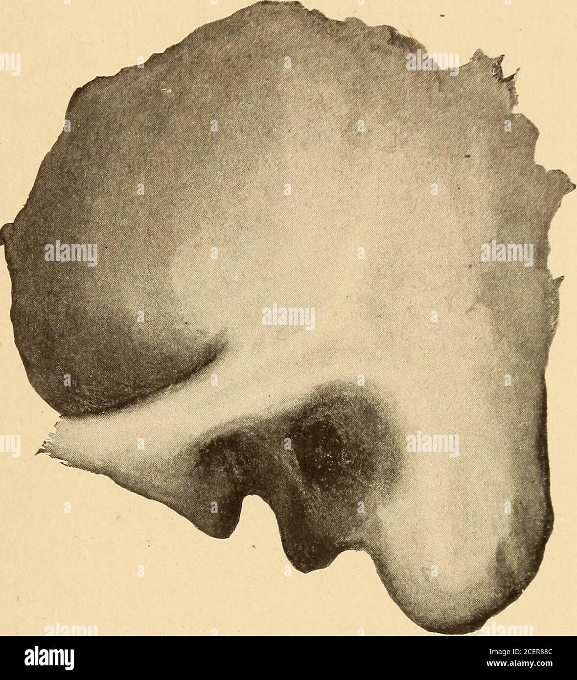 Superior temporal line hi-res stock photography and images - Alamy