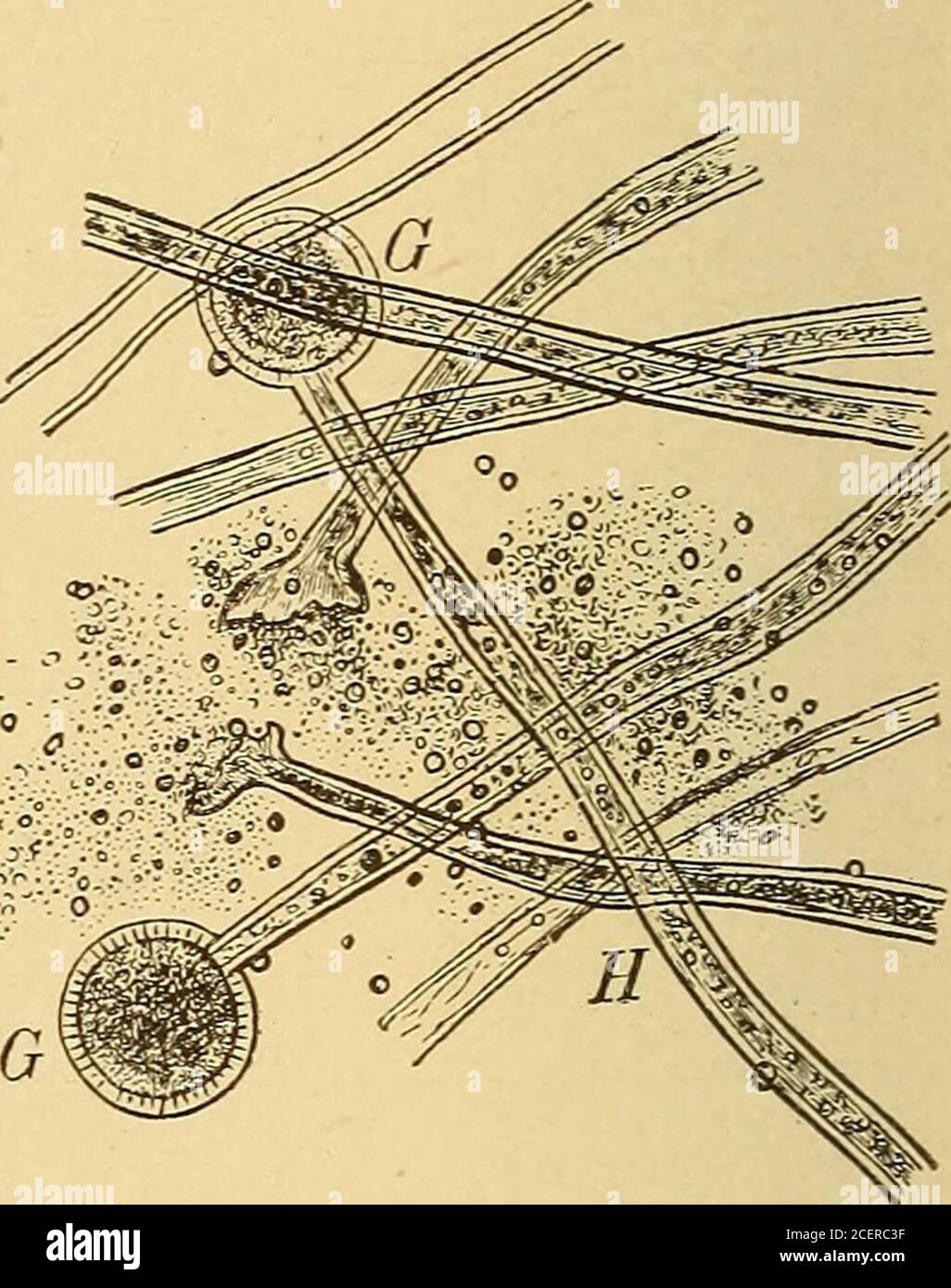 Otomycosis hi-res stock photography and images - Alamy