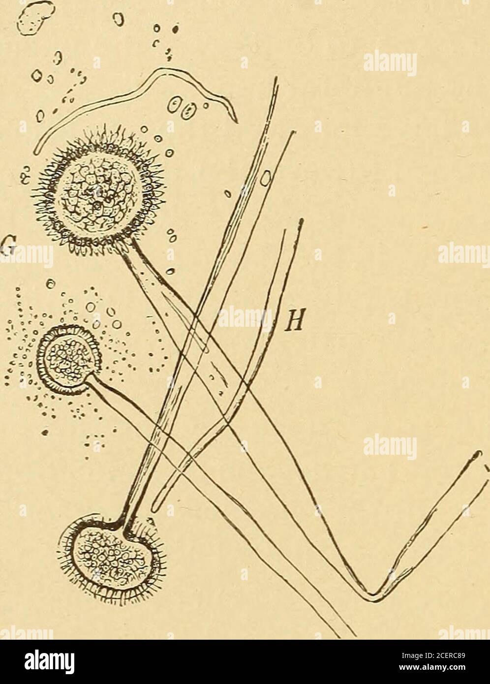 External otitis hi-res stock photography and images - Alamy