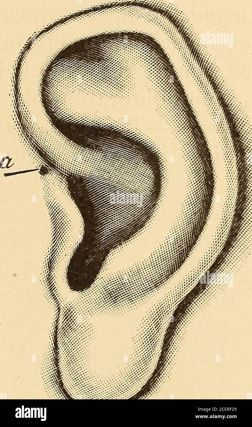 . Diseases of the ear; a text-book for practitioners and students of ...