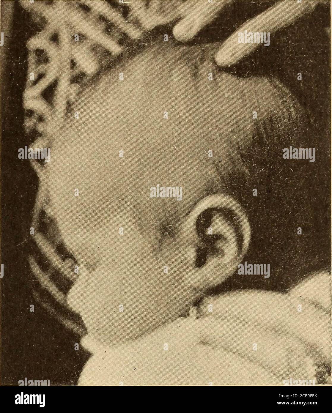 Abnormal race hi-res stock photography and images - Alamy