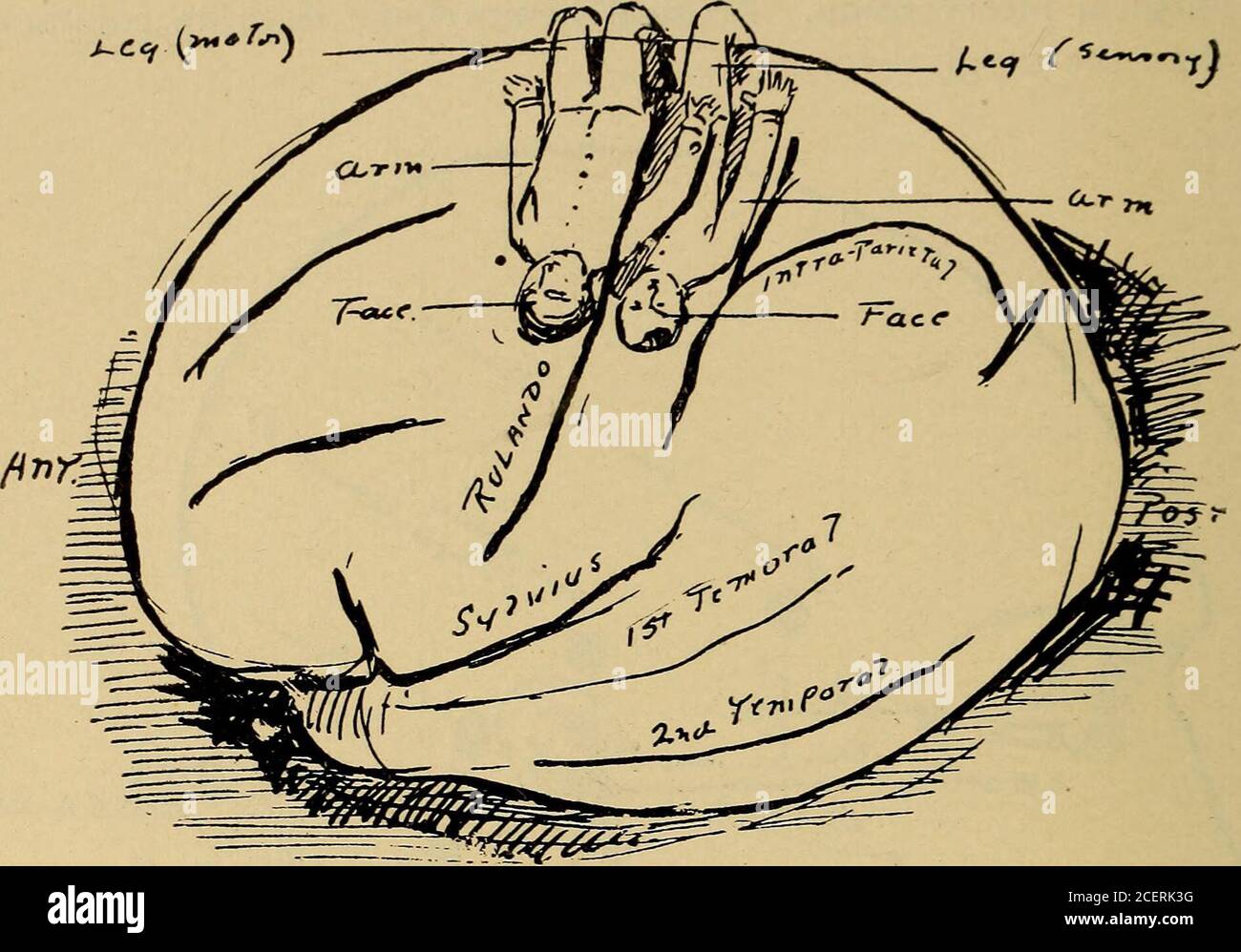 . Surgical differentials. 7P&h$ t. Clrt.b%)tvnt Fig. 19SOME TREPHINE ...