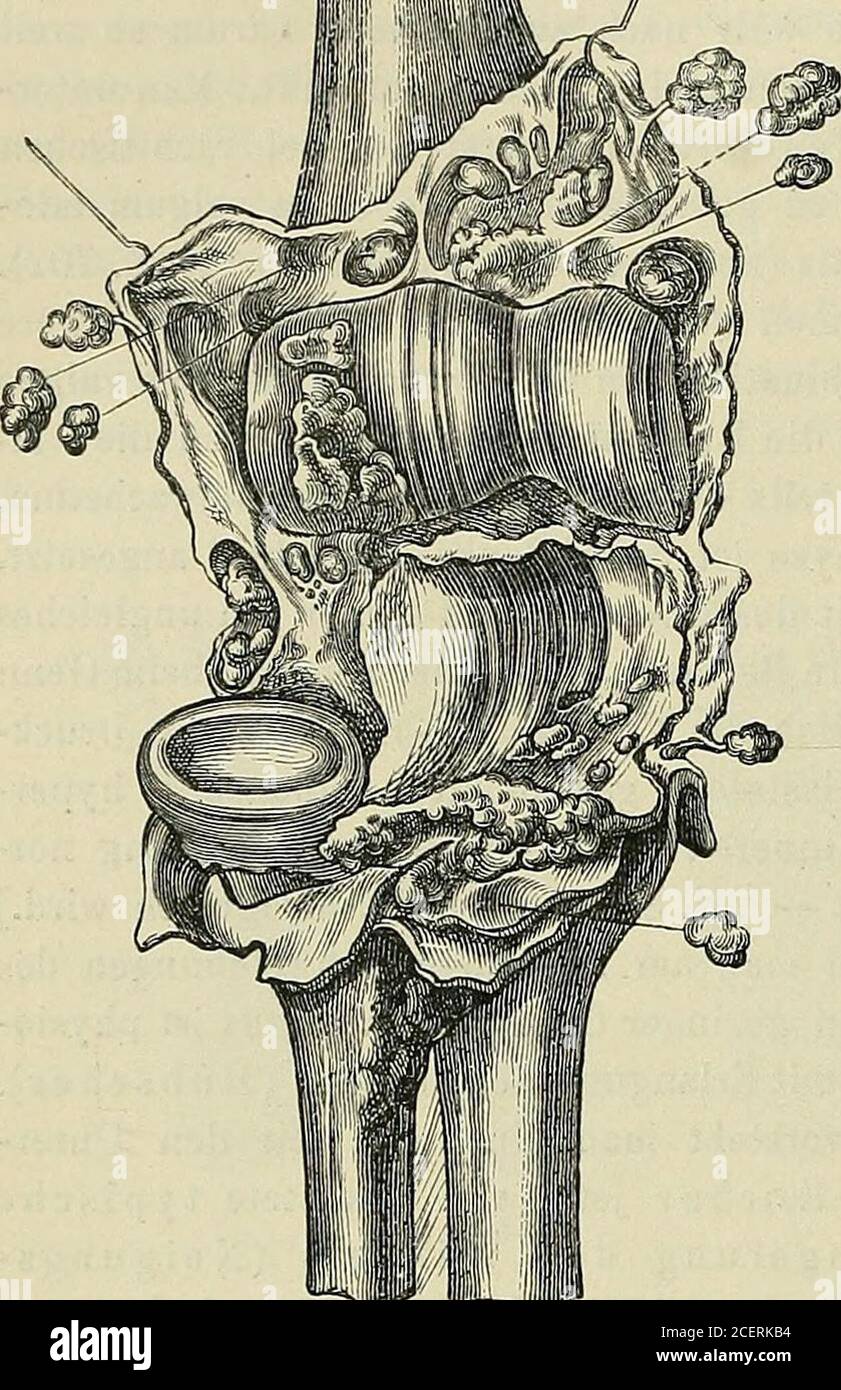 Ellenbogen anatomie hi-res stock photography and images - Alamy