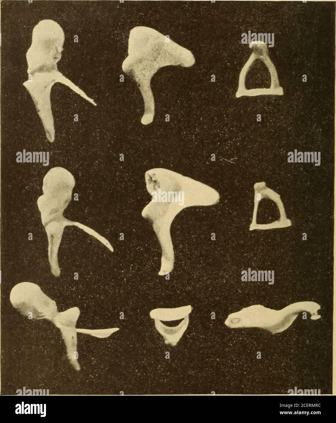 Manubrium of malleus hi-res stock photography and images - Alamy