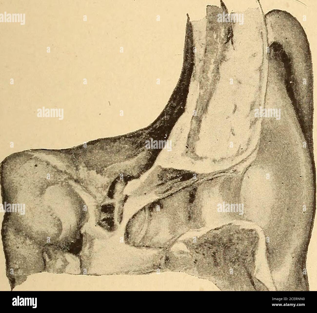. Diseases of the ear; a text-book for practitioners and students of ...