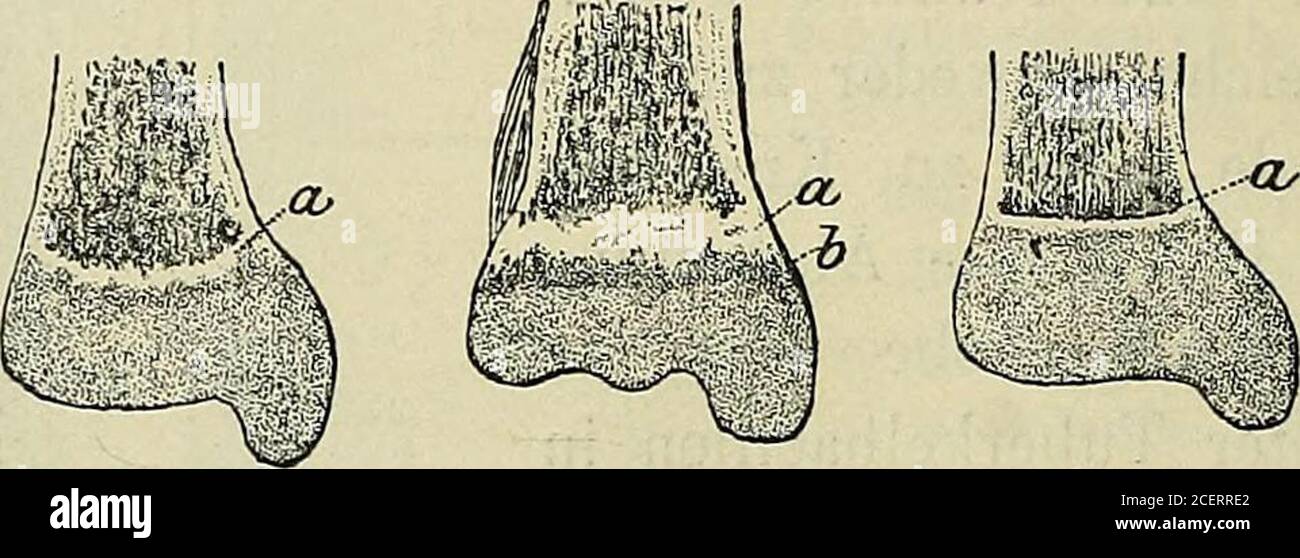 Pankreas anatomie hi-res stock photography and images - Alamy