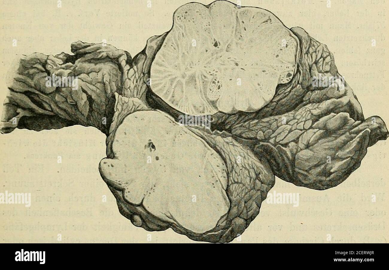 Pankreas anatomie hi-res stock photography and images - Alamy