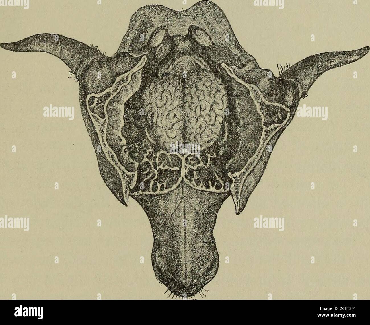 . Postmortem pathology; a manual of the technic of post-mortem ...