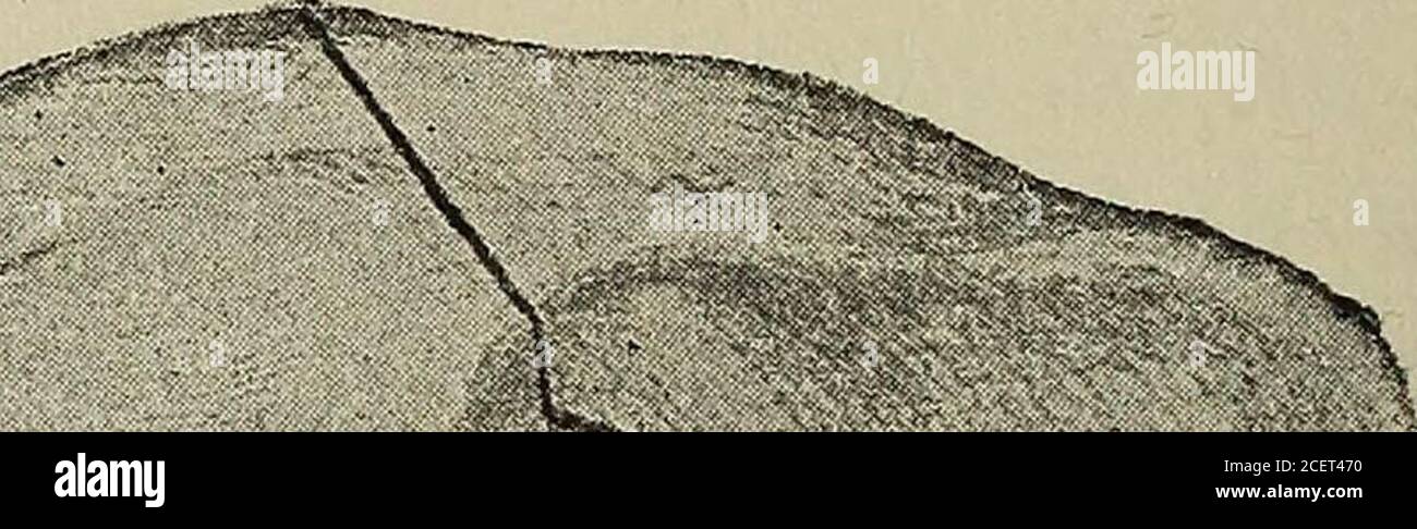 Loose suture hi-res stock photography and images - Alamy