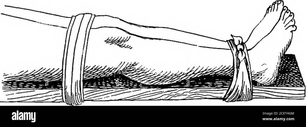 Broken shingles Cut Out Stock Images & Pictures - Alamy