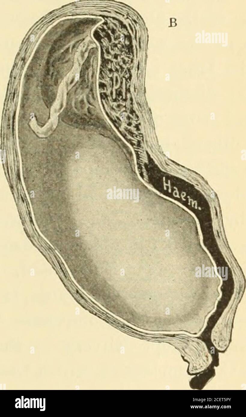 . An American text-book of obstetrics. For practitioners and students ...