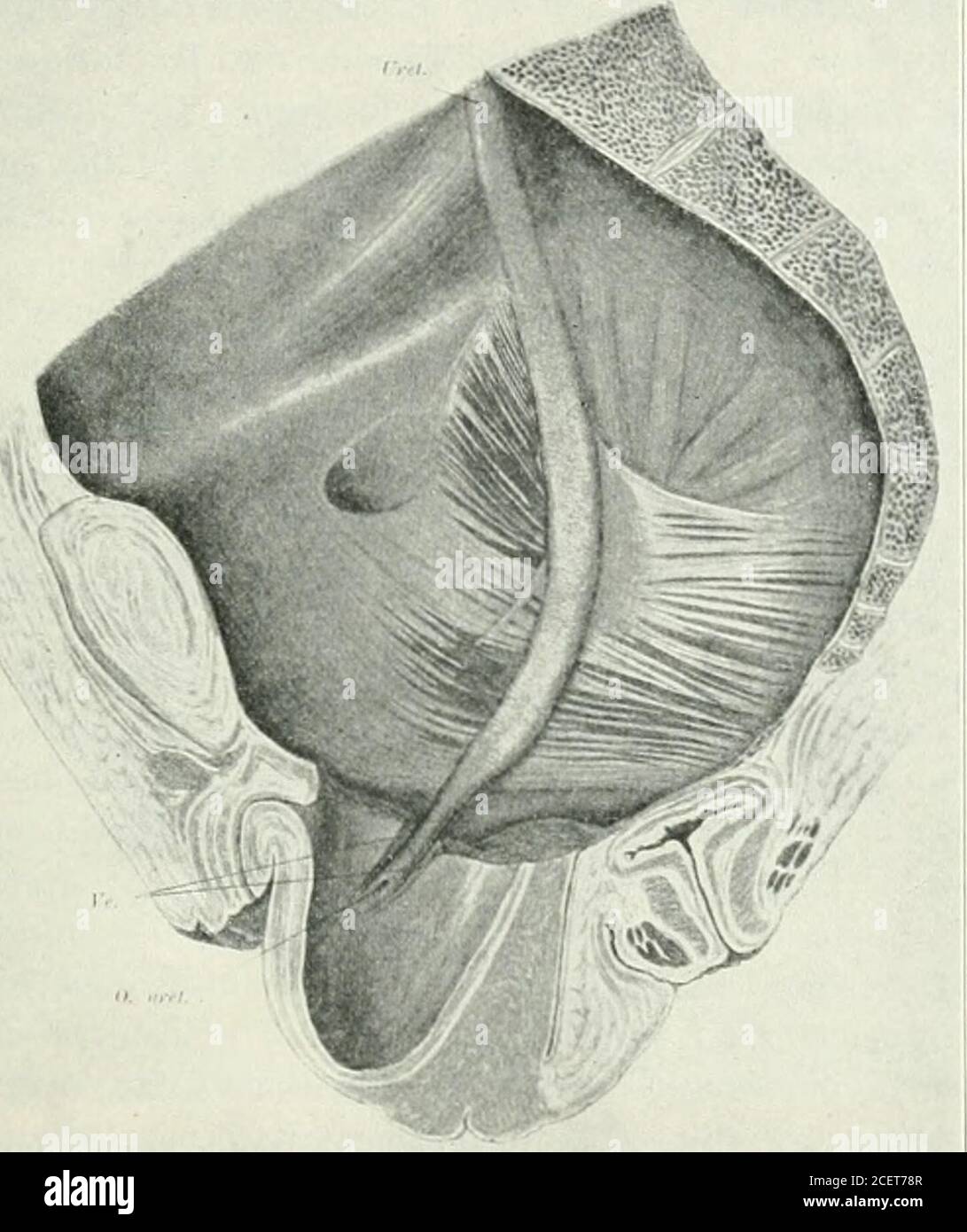 Uterine prolapse hi-res stock photography and images - Alamy