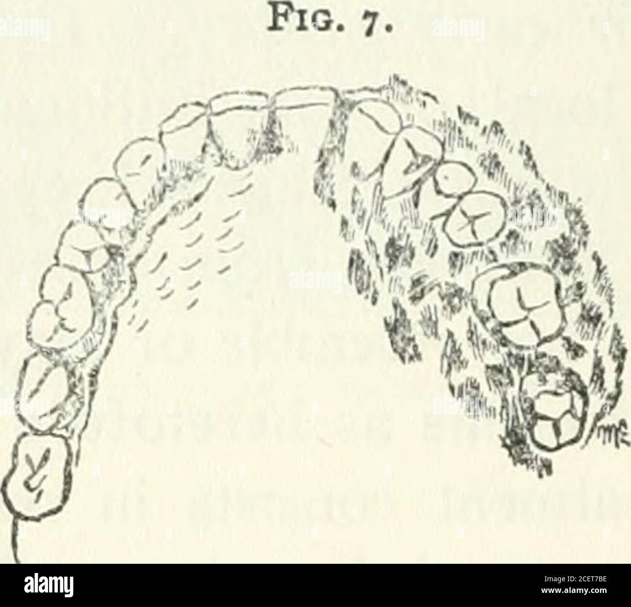 Putrefactive process hi-res stock photography and images - Alamy
