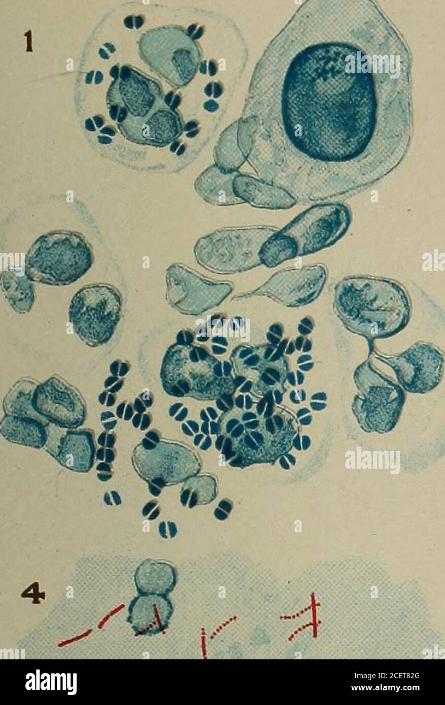 Carbol fuchsin stain hi-res stock photography and images - Alamy