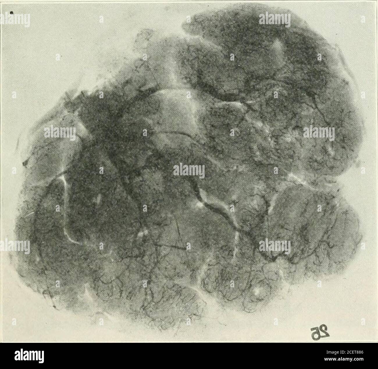 . American journal of obstetrics and gynecology. Fig. 7.—Cross section ...