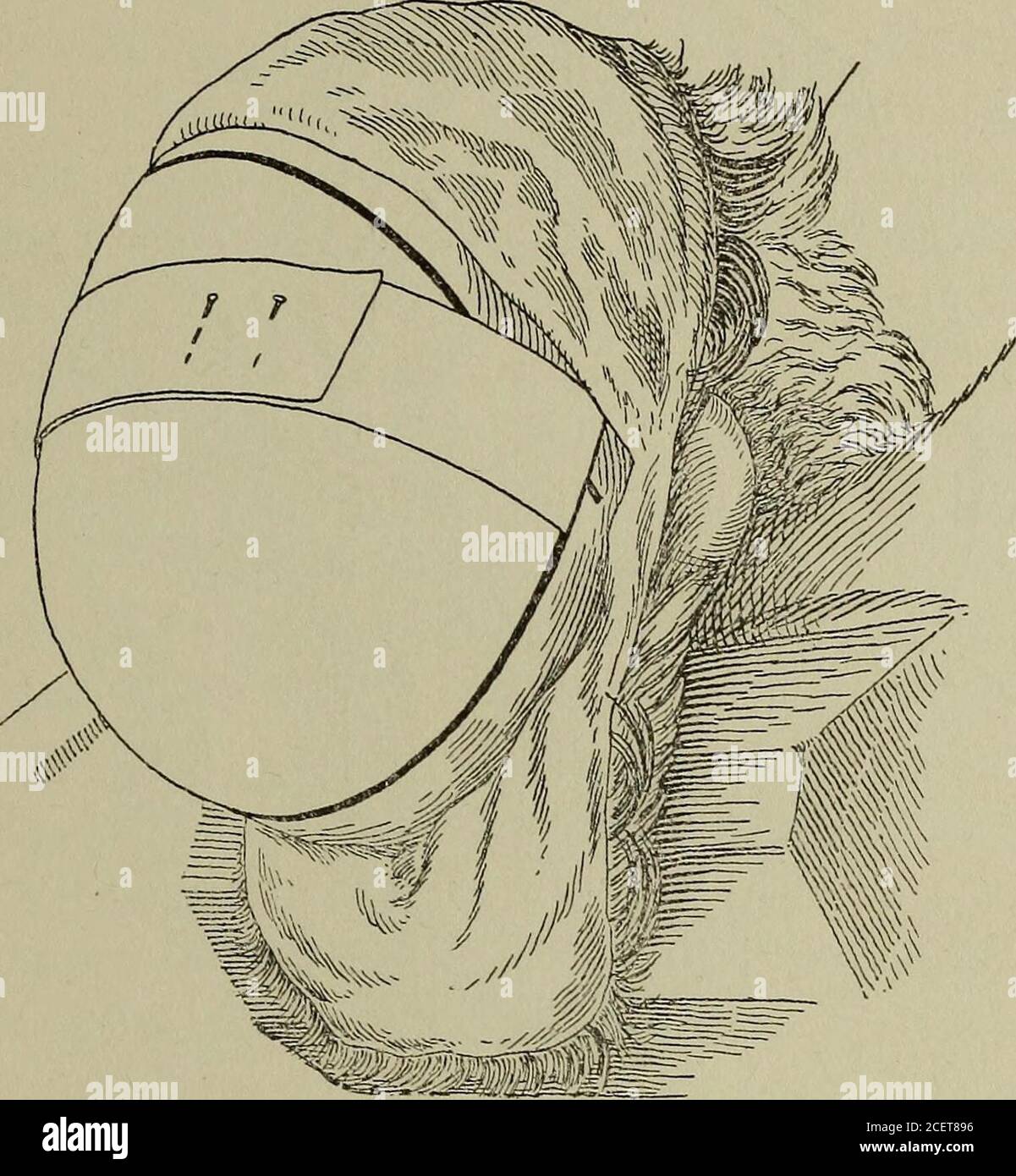 . Postmortem pathology; a manual of the technic of post-mortem ...