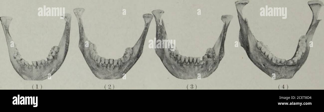 . The Dental cosmos. is entirely absent, whenboth condj les are seated ...