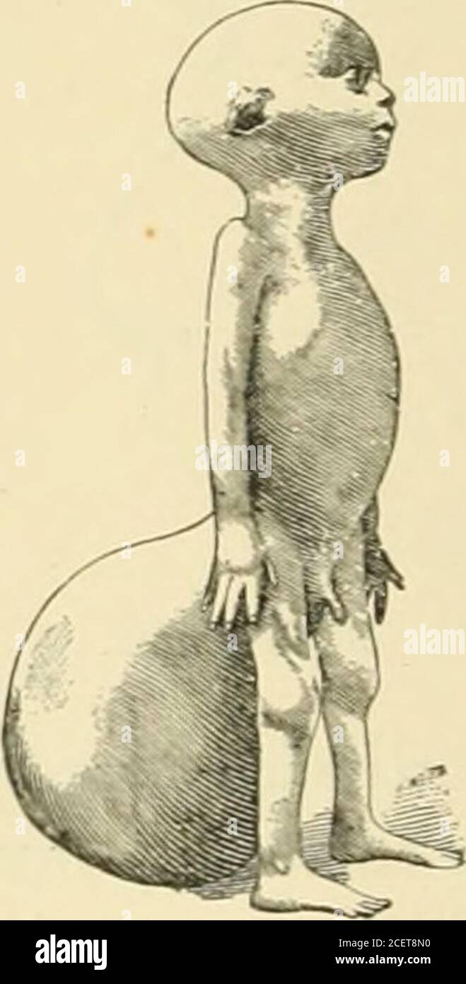 . An American text-book of obstetrics. For practitioners and students ...