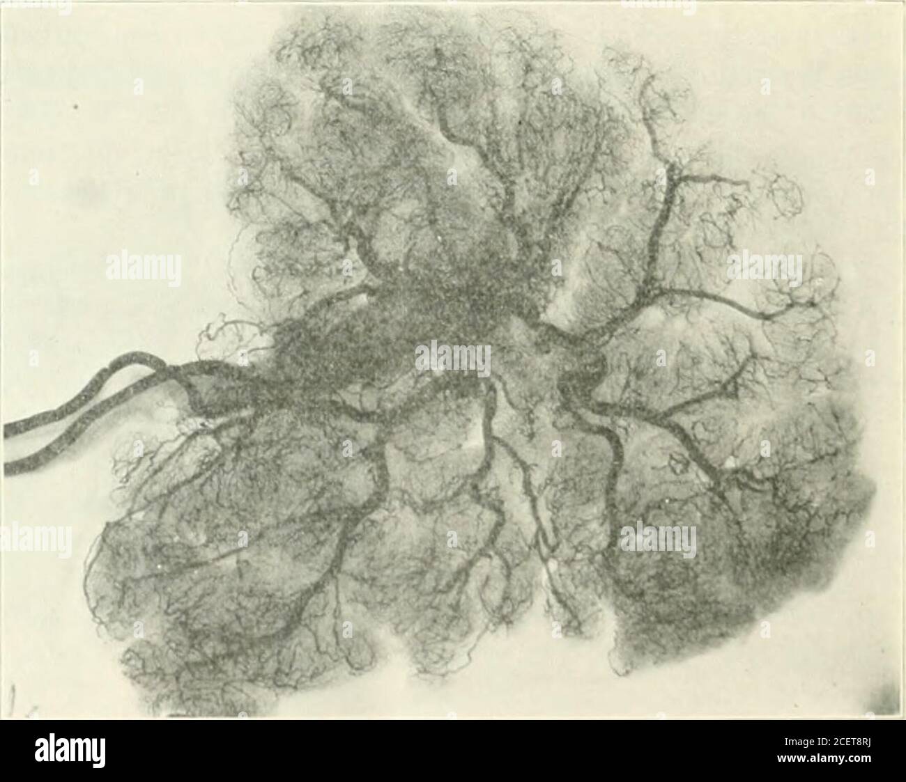 Placental injection hi-res stock photography and images - Alamy