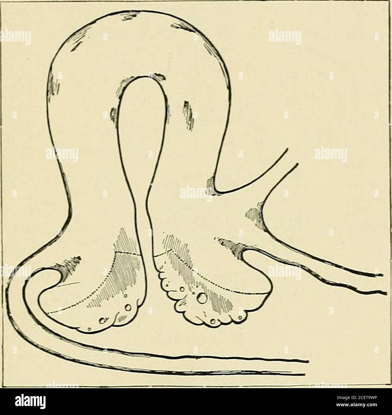 Laceration large hi-res stock photography and images - Alamy