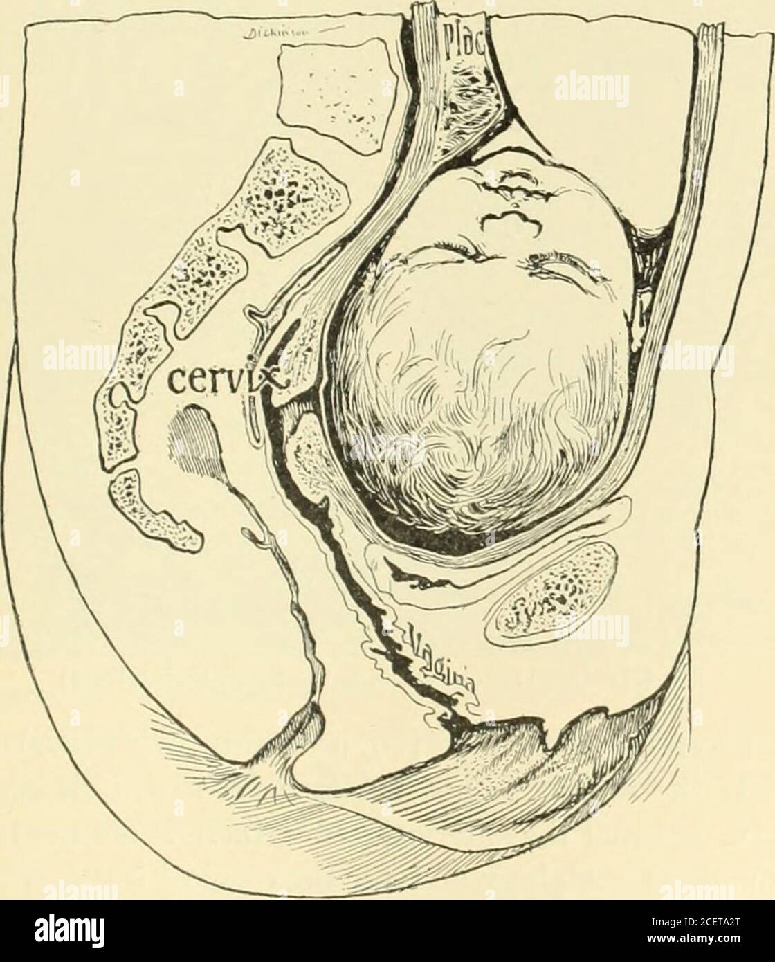 Bulk tissues hi-res stock photography and images - Alamy