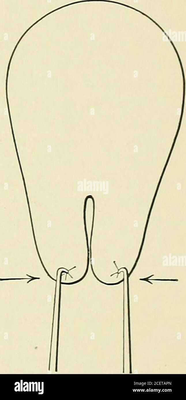 Everted Lips High Resolution Stock Photography and Images - Alamy