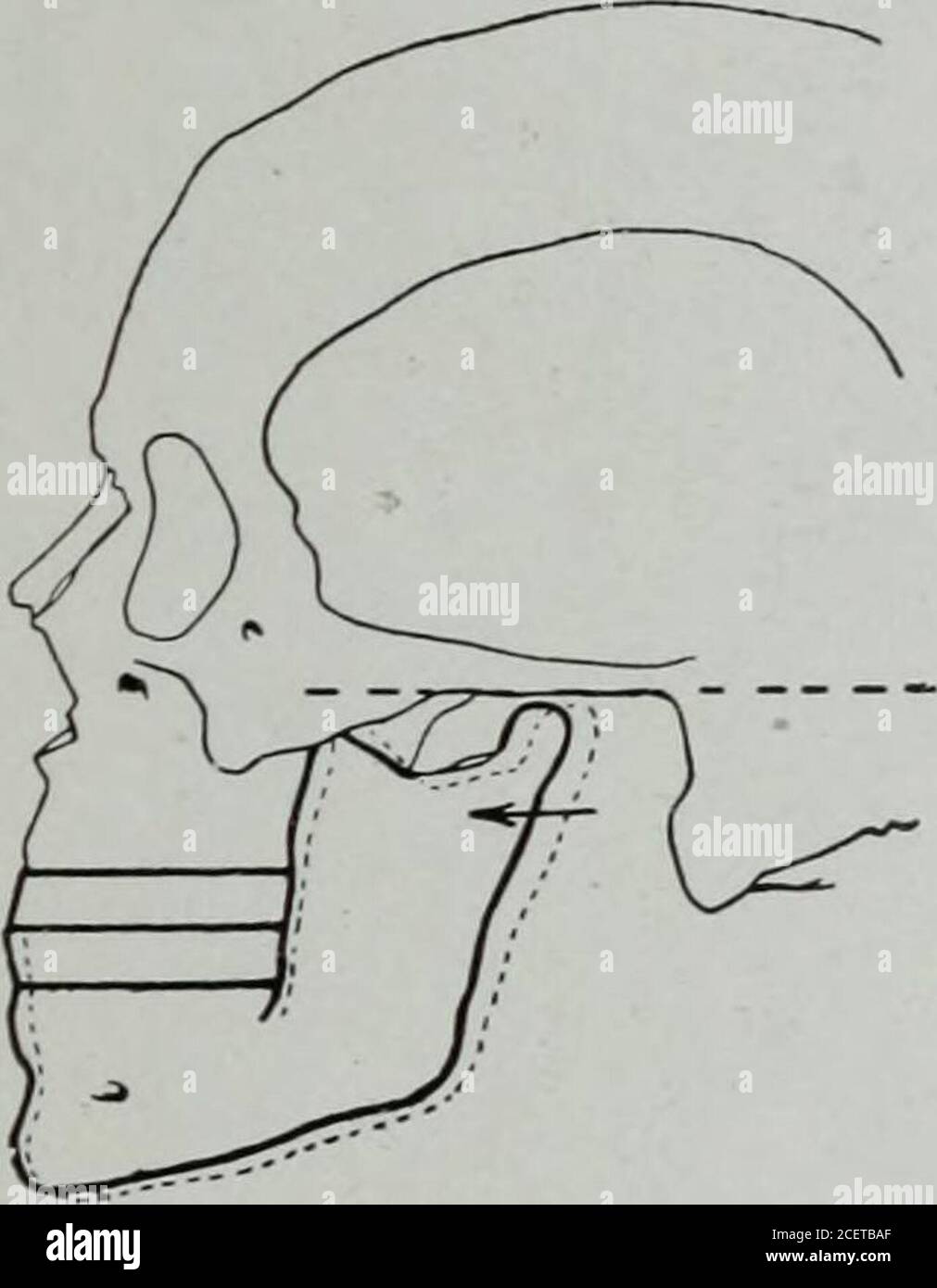 . The Dental cosmos. Represents a deep glenoid cavity, andaccordingly ...