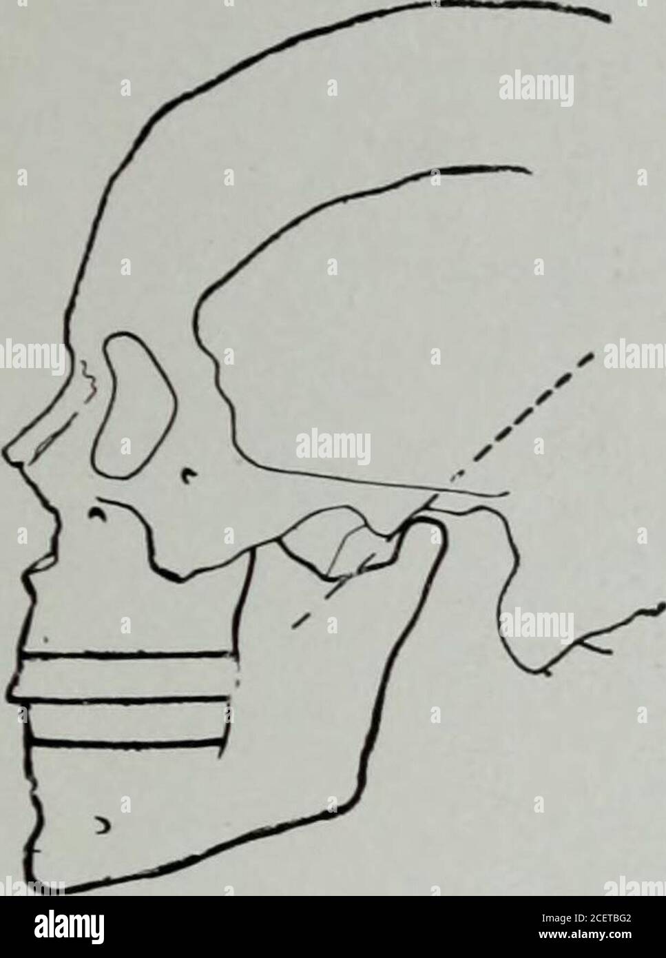 . The Dental cosmos. Registration of a horizontal condyle path, and ...