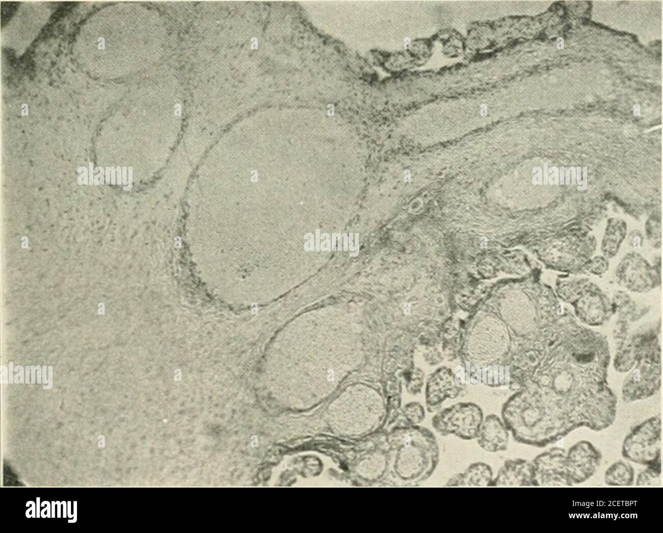 Placenta tissue hi-res stock photography and images - Alamy