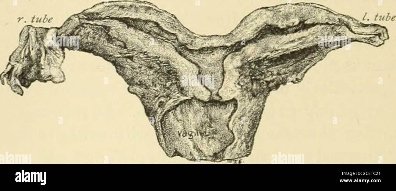 . An American text-book of obstetrics. For practitioners and students ...