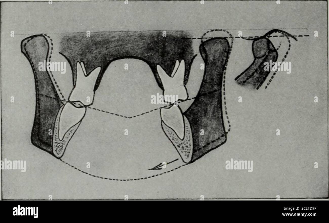 Interarticular hi-res stock photography and images - Alamy