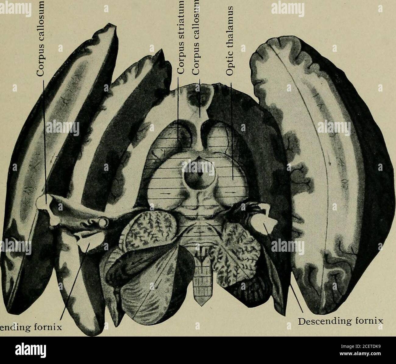 . Postmortem pathology; a manual of the technic of post-mortem ...