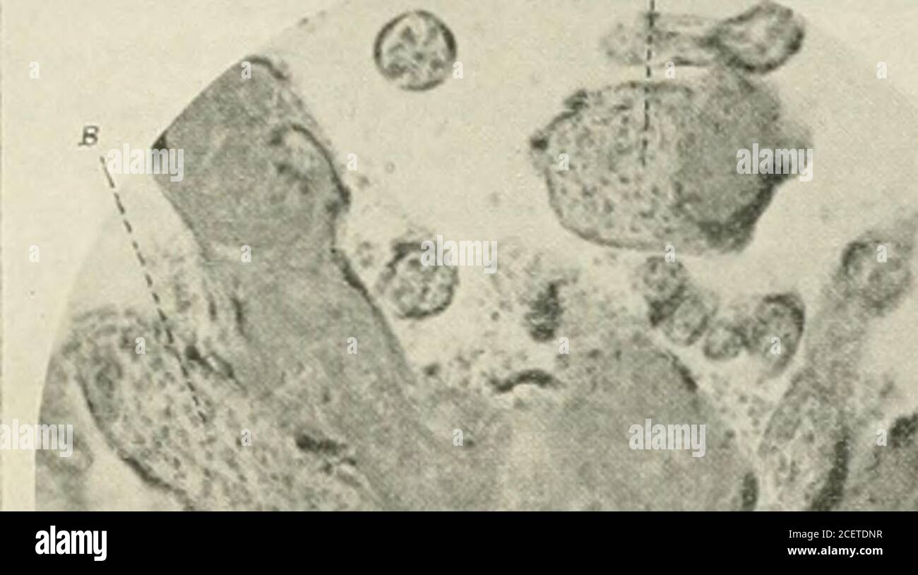 Syncytia hi-res stock photography and images - Alamy