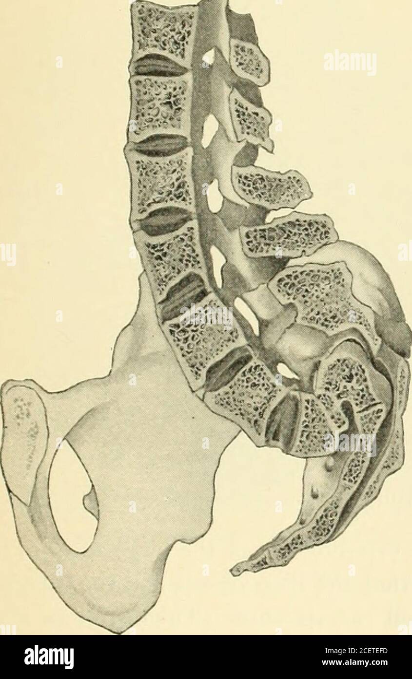 . An American text-book of obstetrics. For practitioners and students ...