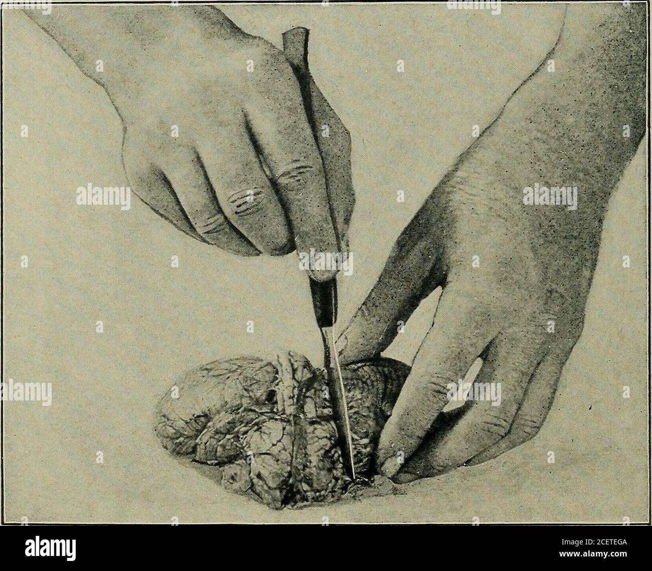 Linear fracture hi-res stock photography and images - Alamy