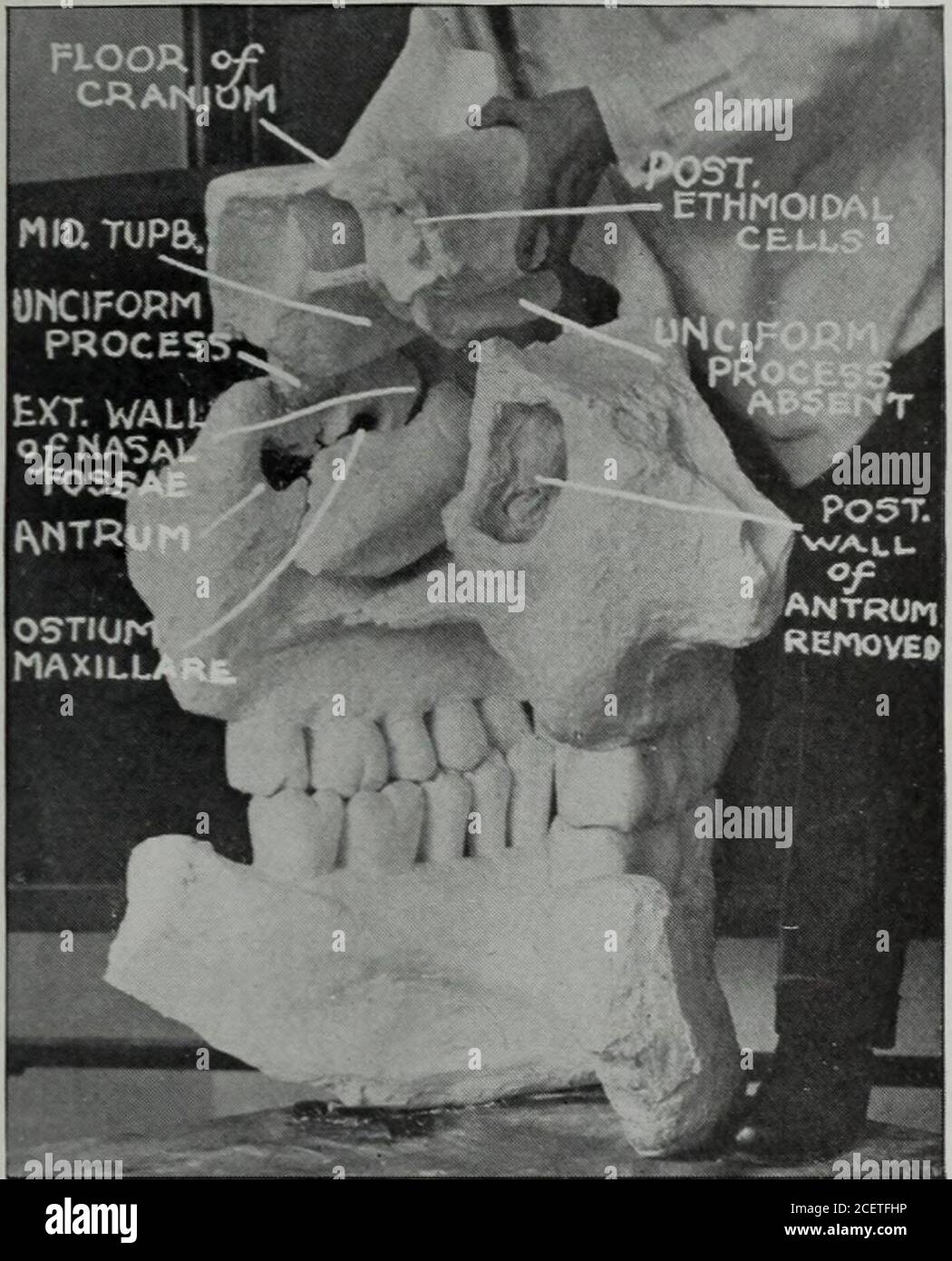 . The Dental cosmos. Showing balance of normal occlusion and With ...