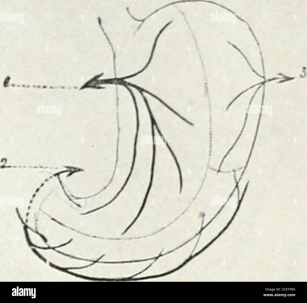 . Annals of surgery. General view of the subperitoneal network of ...