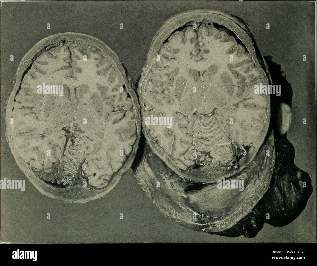 . Postmortem pathology; a manual of the technic of post-mortem ...