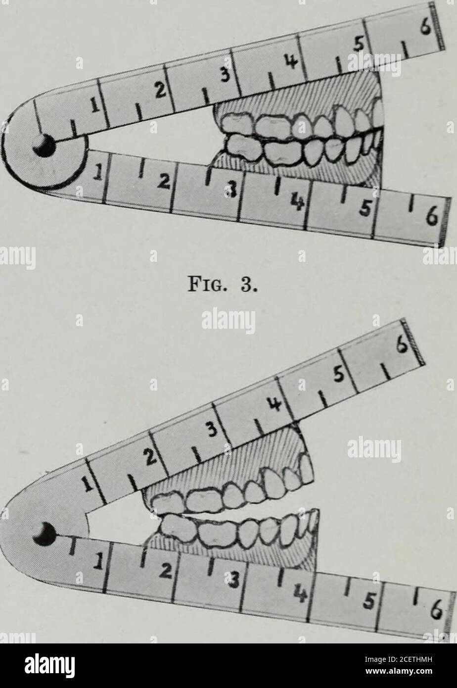 . The Dental cosmos. man jaw. The Bonwill theory enterslargely into the ...