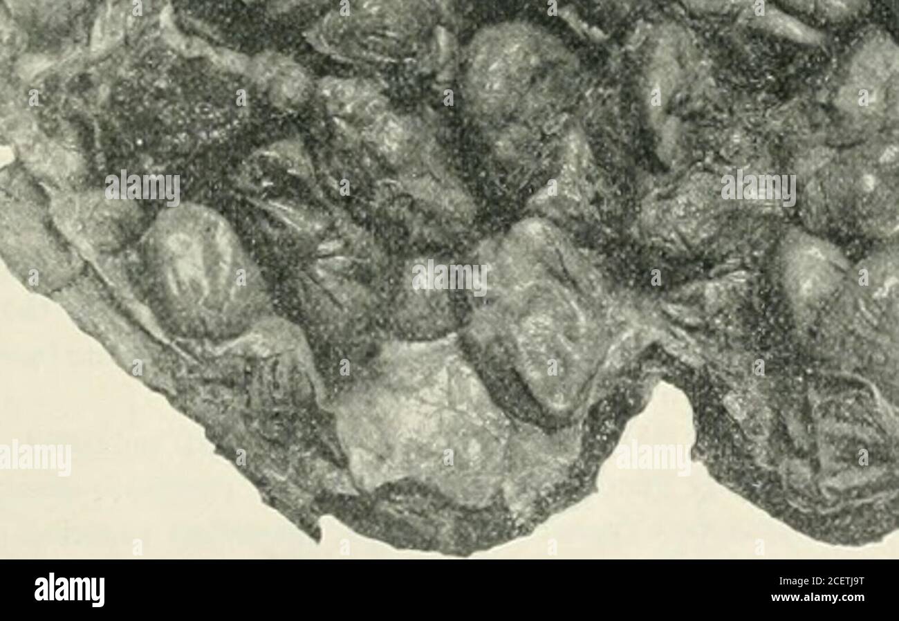 . American journal of obstetrics and gynecology. Fig. 2.—Specimen cut ...