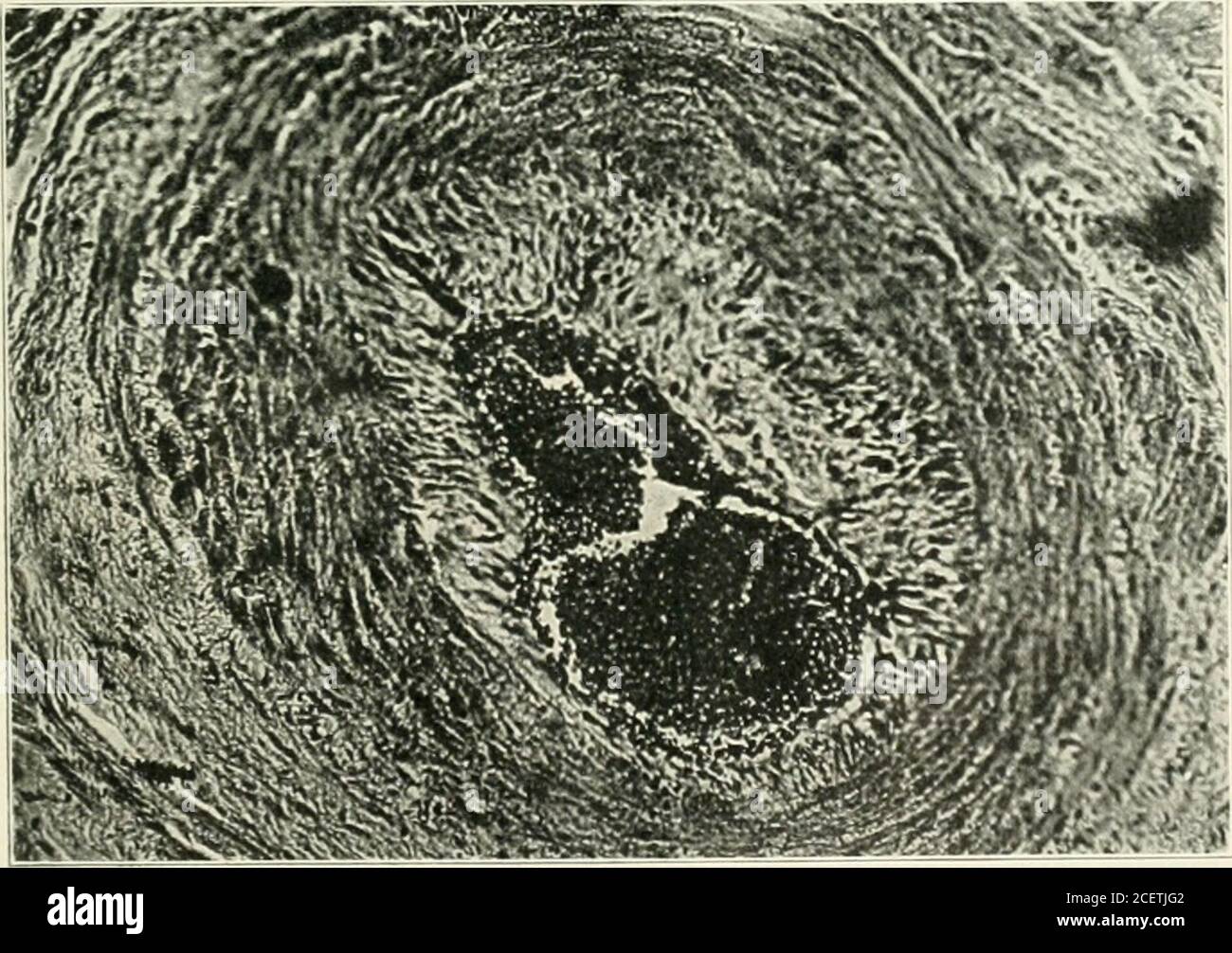 Fetal membrane hi-res stock photography and images - Alamy